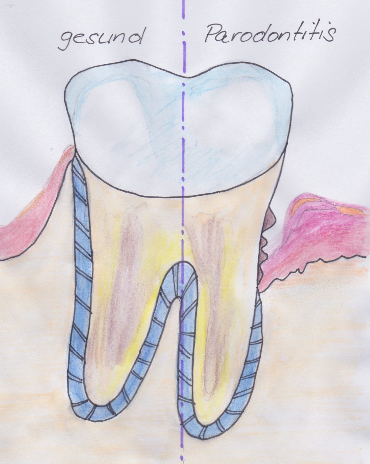 Parodontologie - Ganzheitliche Zahnarztpraxis Dr. Heike Kretschmar